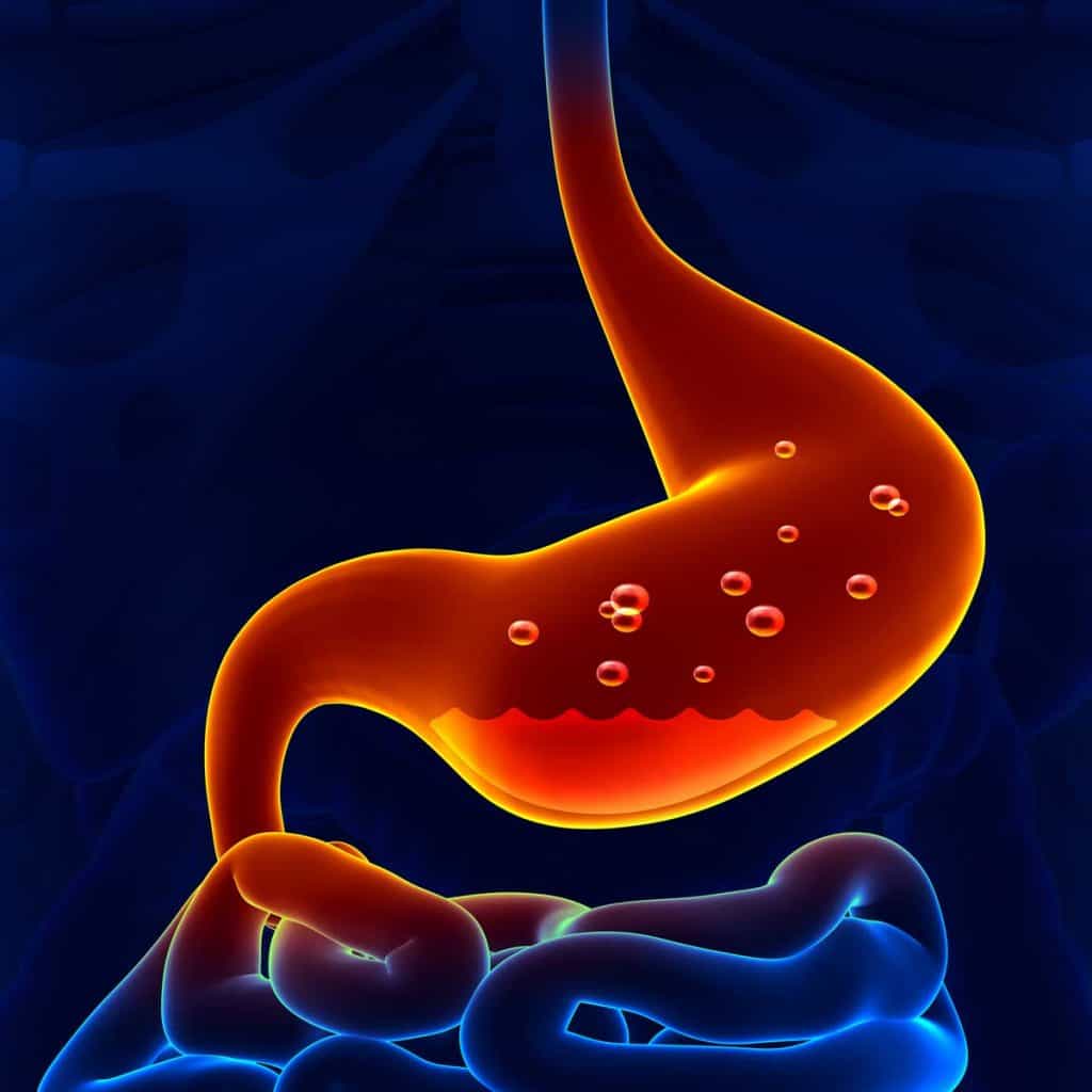 Why Your Bones Need Stomach Acid (And How To Ensure You're Producing ...